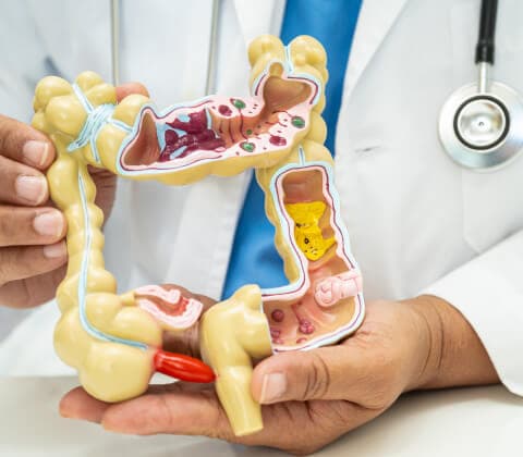 Expert Colonoscopy Cancer Care | MedStar Shah Medical Group