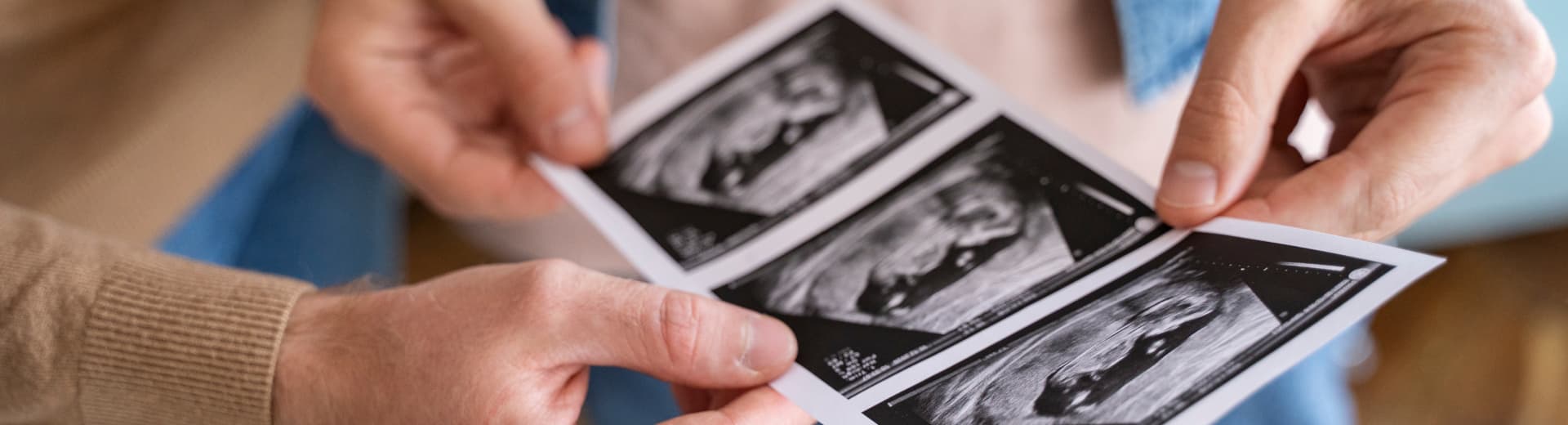 Ultrasound Scan | MedStar Shah Medical Group